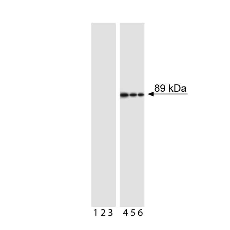 BD Purified Mouse Anti-Cleaved PARP (Asp214) | 캐시바이